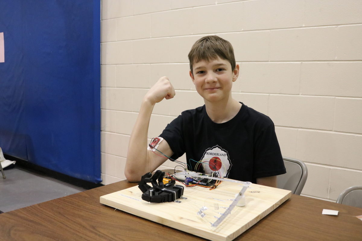 Prosthetics project - Fort Frances Times
